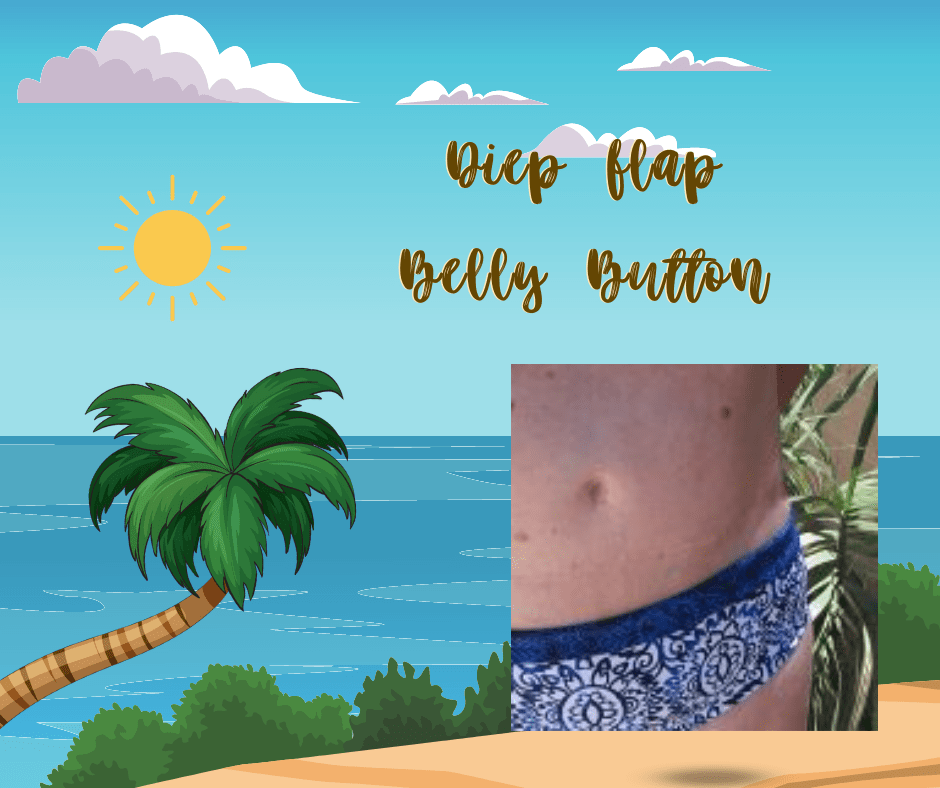 Diep Flap Belly Button Diepcjourney
